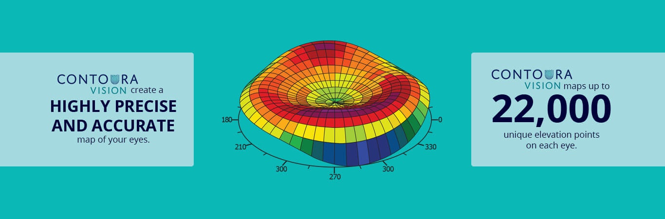 What is Contoura LASIK?